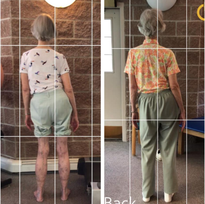 Postural Alignment Therapy